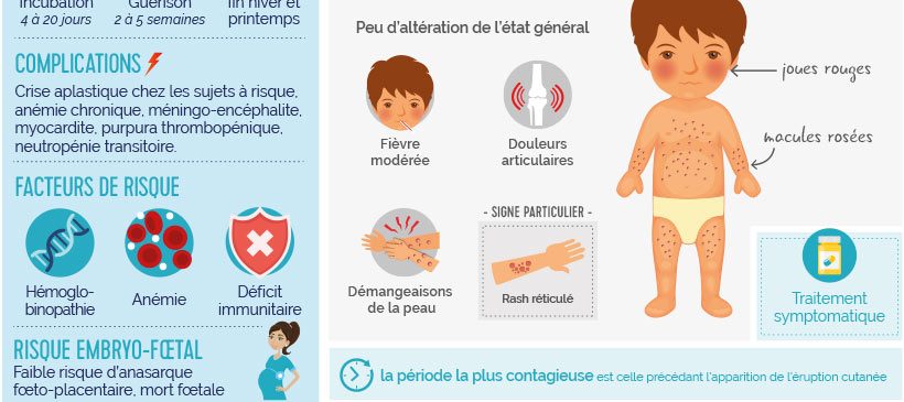 Érythème infectieux ou mégalérythème ou la 5ème maladie - Santé sur le ...