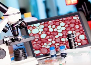 La biopsie : Définition, symptômes, diagnostic et traitements.