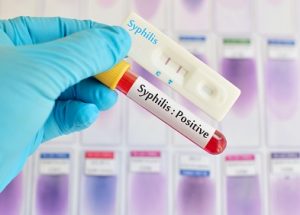 Syphilis : histoire, symptômes, diagnostic, traitement