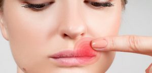 Roséole infantile ou exanthème subit ou la sixième maladie - Santé sur ...