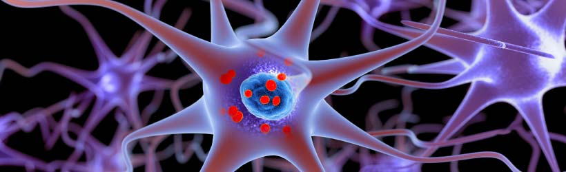 Démence à corps de Lewy : Définitions, symptômes et traitements