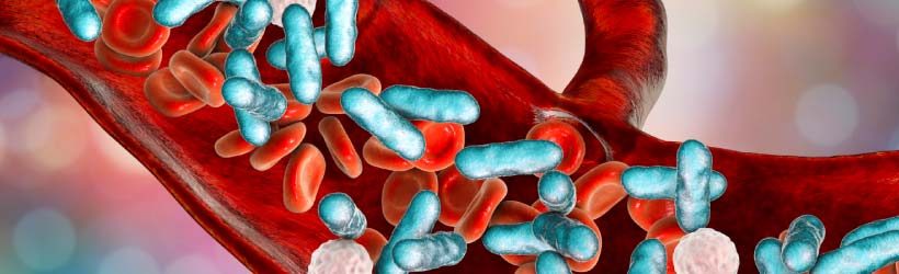 Septicémie : Définition, Symptômes, Diagnostic et traitement