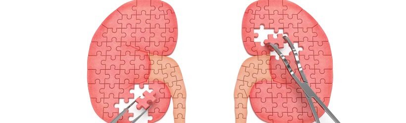 Cancer du rein : symptômes, diagnostic, traitement