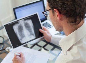 Sarcoïdose : Définition et symptômes - Santé sur le Net