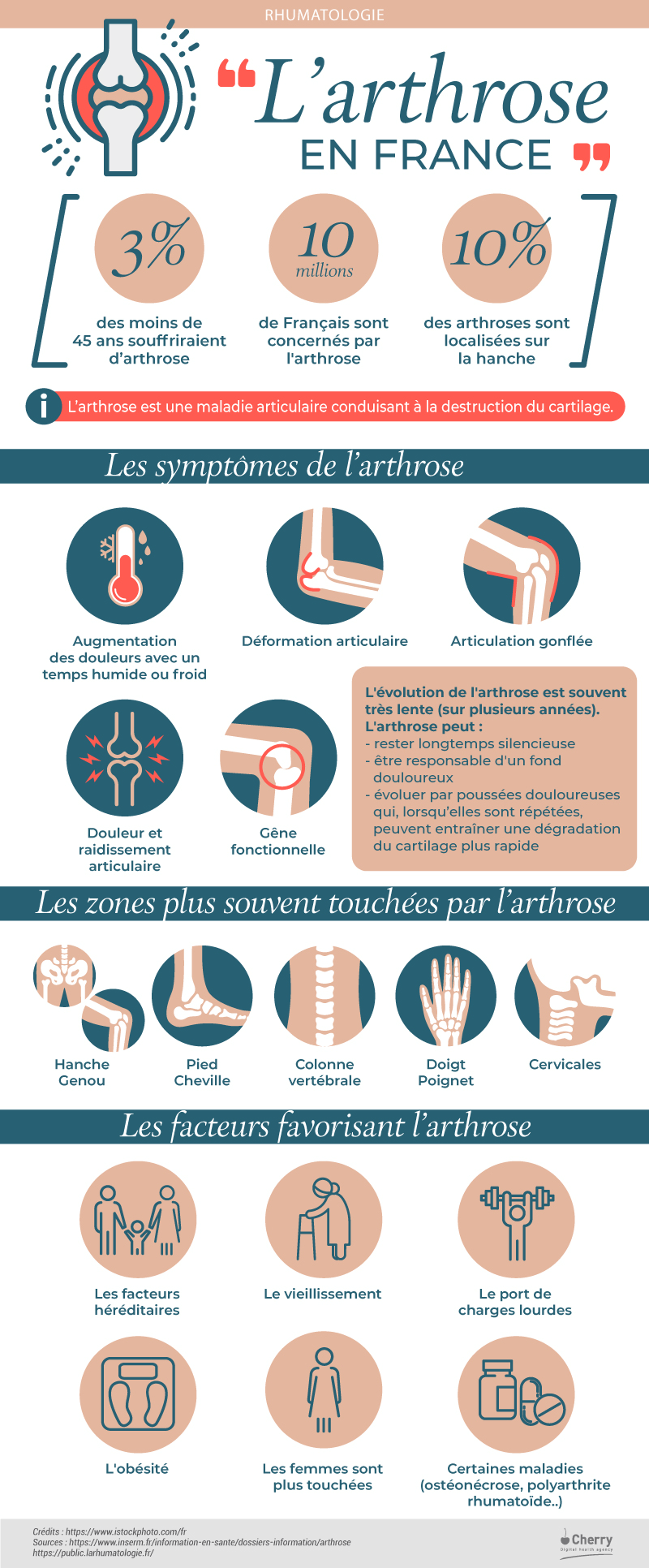 L’arthrose en France - Santé sur le Net, l’information médicale au cœur ...