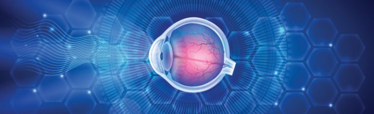 Syndrome de Claude Bernard Horner : définition - Santé sur le Net