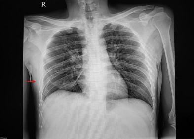 Pneumologie - Tout savoir sur les maladies des voies respiratoires