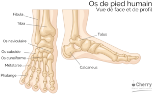 Pied bot : Symptômes, diagnostic et traitements