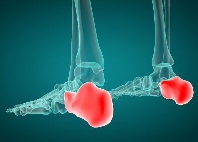 Rhumatologie : tout sur les affections - Santé sur le Net