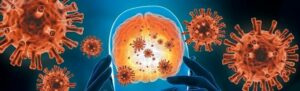 Syndrome méningé : Définition, symptômes, diagnostic, traitements