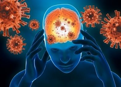 Neurologie - Maladies du système nerveux et du cerveau