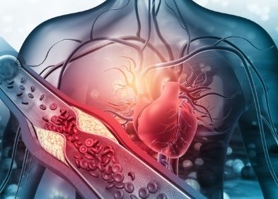 Cardiologie : dossier complet - Santé sur le Net