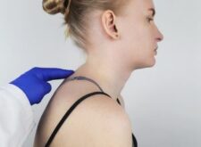 Cyphose : Définition, symptômes, diagnostic et traitements