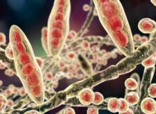 Intertrigo : Définition, symptômes, diagnostic et traitements