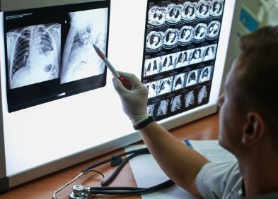 Pneumologie - Tout savoir sur les maladies des voies respiratoires