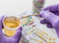 Pollakiurie ou mictions fréquentes : définition, causes et traitements