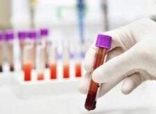Bilan sanguin : Objectifs, déroulé et description des résultats
