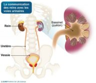 Pyélonéphrite : définition, symptômes, causes et traitement