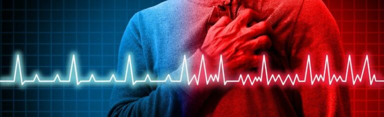 Arythmie (ou troubles du rythme cardiaque) : symptômes