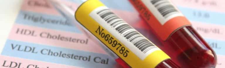 Hypercholestérolémie : définition, causes et complications