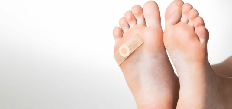 Verrue plantaire ou cor au pied : quelle différence