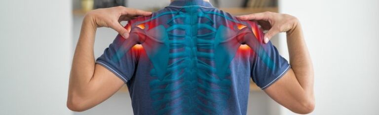 Périarthrite : Définition, symptômes, diagnostic et traitements