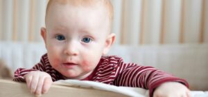 Eczéma du nourrisson : comment l'identifier ? Santé sur le Net