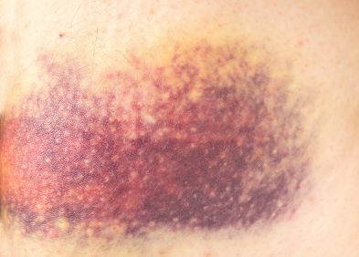 Dermatologie : tout savoir - Santé sur le Net