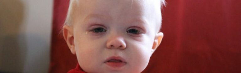 Conjonctivite : comment protéger son bébé - Santé sur le Net