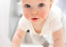 Maladies infantiles : Varicelle, rougeole, roséole, rubéole ...