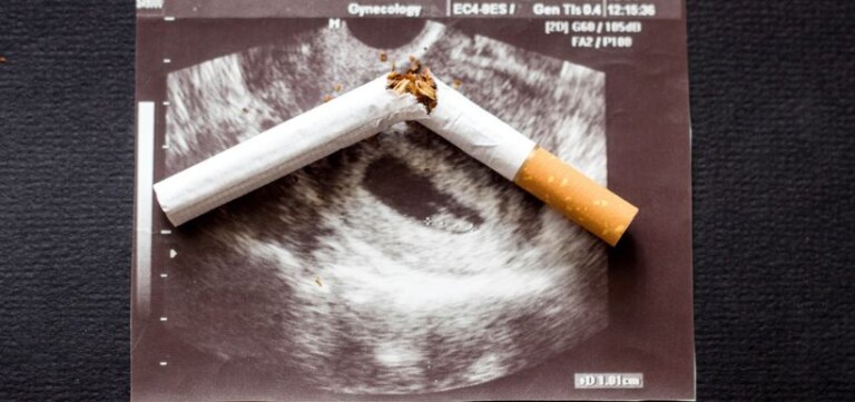 Adénofibrome : définition et prise en charge - Santé sur le Net